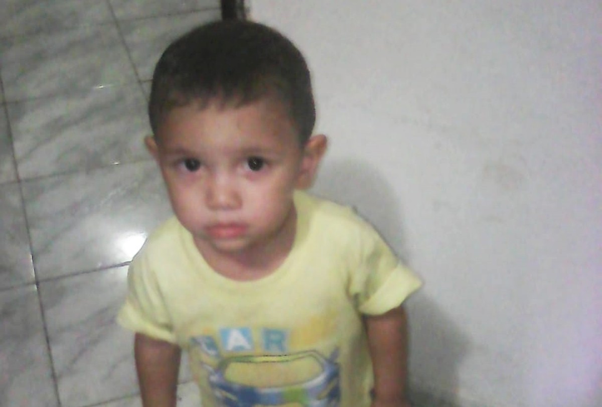 Menino De 2 Anos é Atingido Por Coice De Cavalo Enquanto Brincava Em