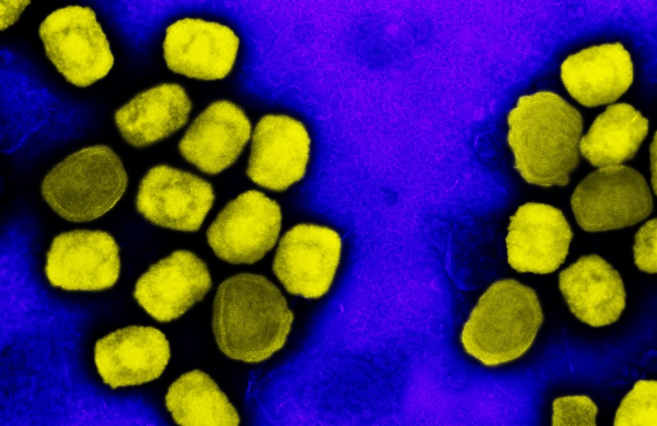 Brasil confirma transmissão local de varíola dos macacos; entenda os ...