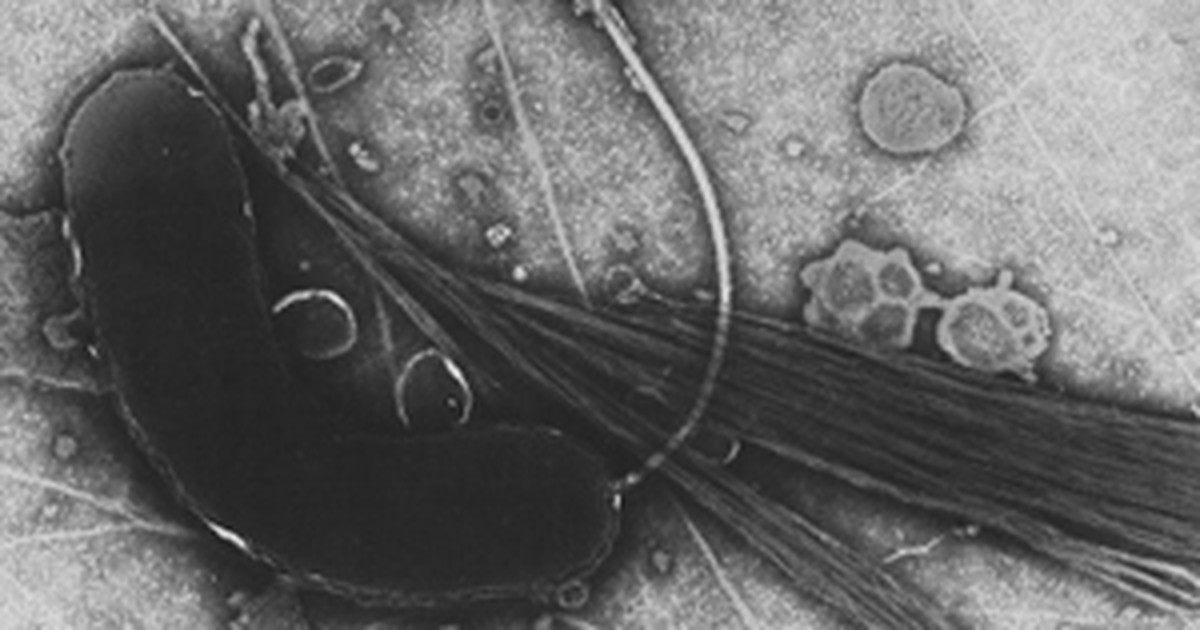 G1 - Cientistas conseguem sequenciar genoma da bactéria da cólera ...