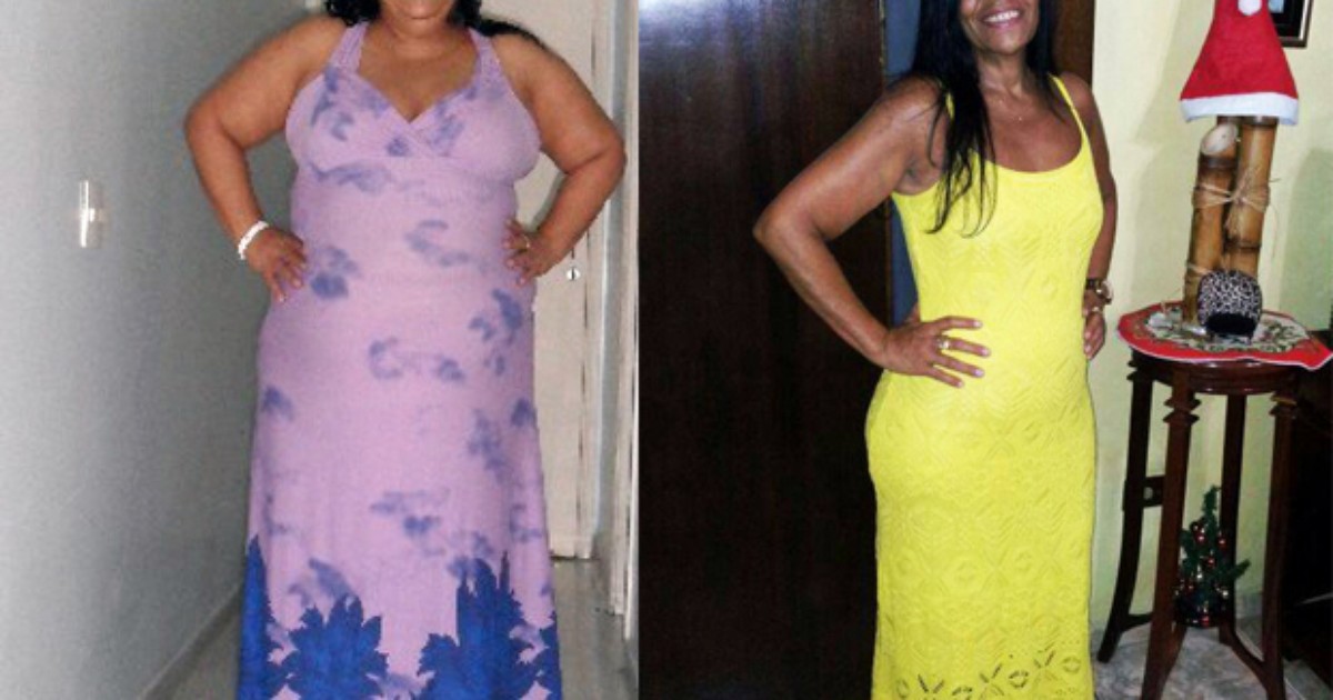 G1 - Excesso de peso 'escondia' tumores em ex-obesa confundida com ...