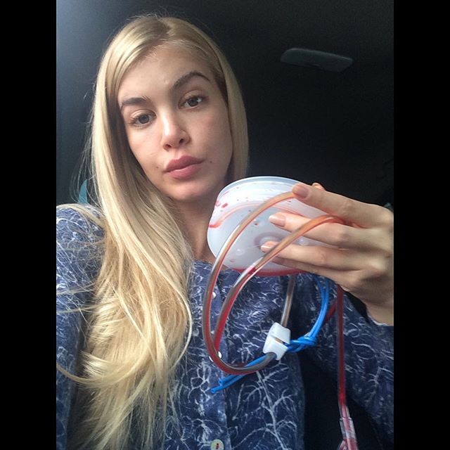 Modelo Kat Torres retira um dos seios: "É um erro da vida" - Quem ...