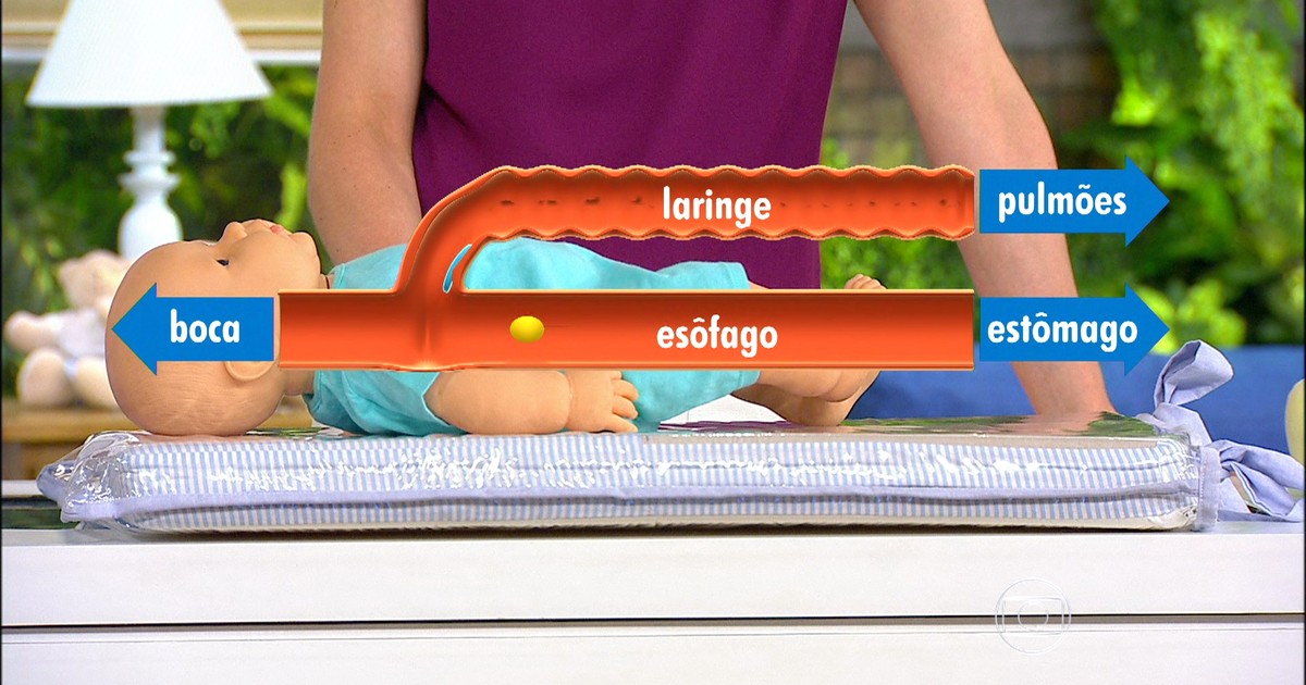 Bem Estar - Saiba o que fazer em caso de engasgo ou intoxicação nas ...