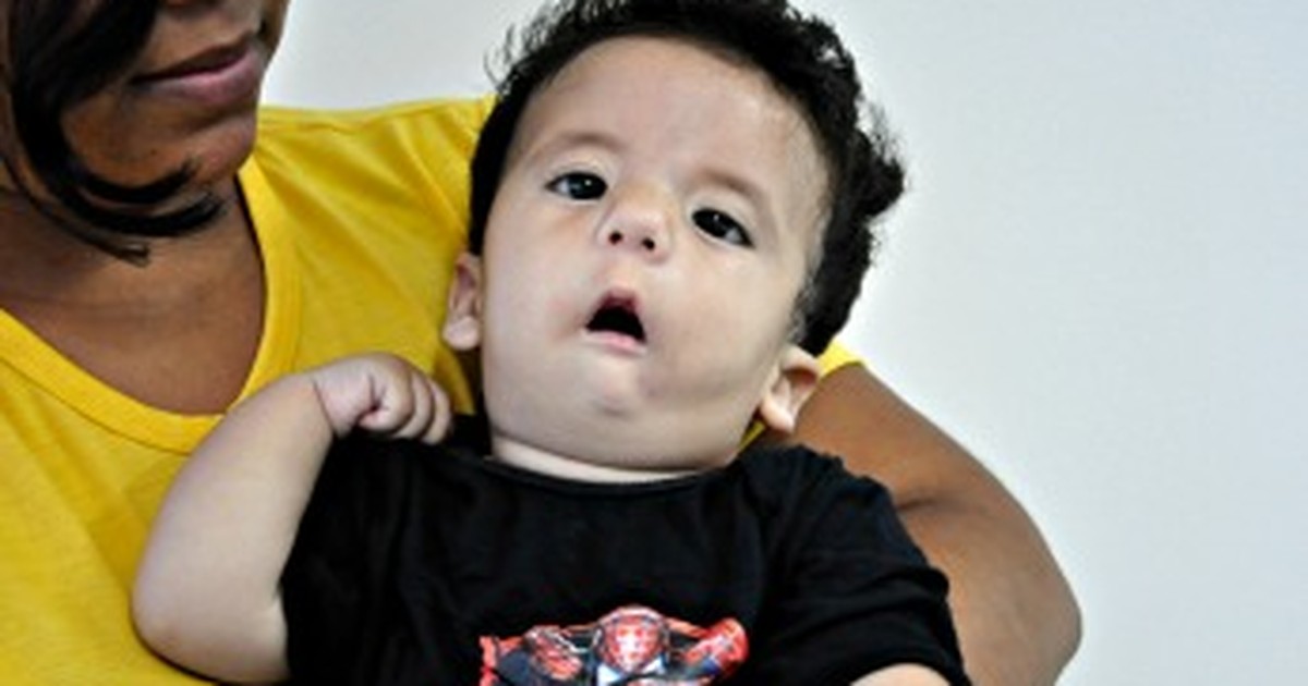 G1 - Após 2 decisões judiciais, bebê sem queixo aguarda por cirurgia em ...