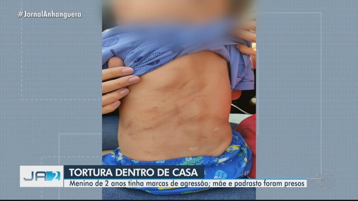 Mãe E Padrasto São Presos Suspeitos De Torturar Criança De 2 Anos Em