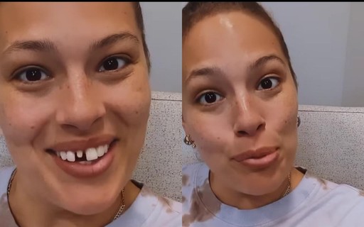 Ashley Graham mostra dente quebrado após comer cookie congelado - Vogue ...