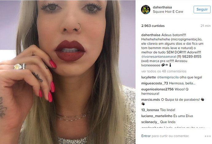 "Adeus, batom": Thaísa realiza novo procedimento estético nos lábios