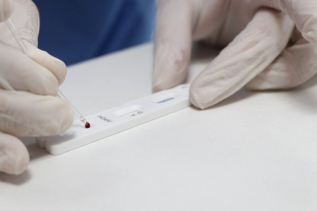 Chega a 67 o número de casos confirmados do novo coronavírus em ...