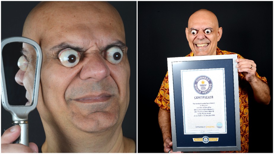 Brasileiro quebra recorde de homem com olhos mais saltados do mundo ...