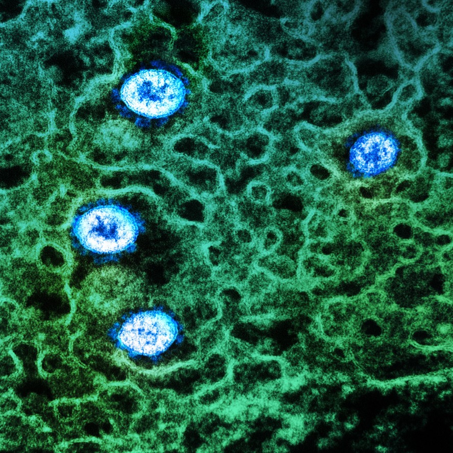 Por que a Ômicron deverá ficar sempre por perto