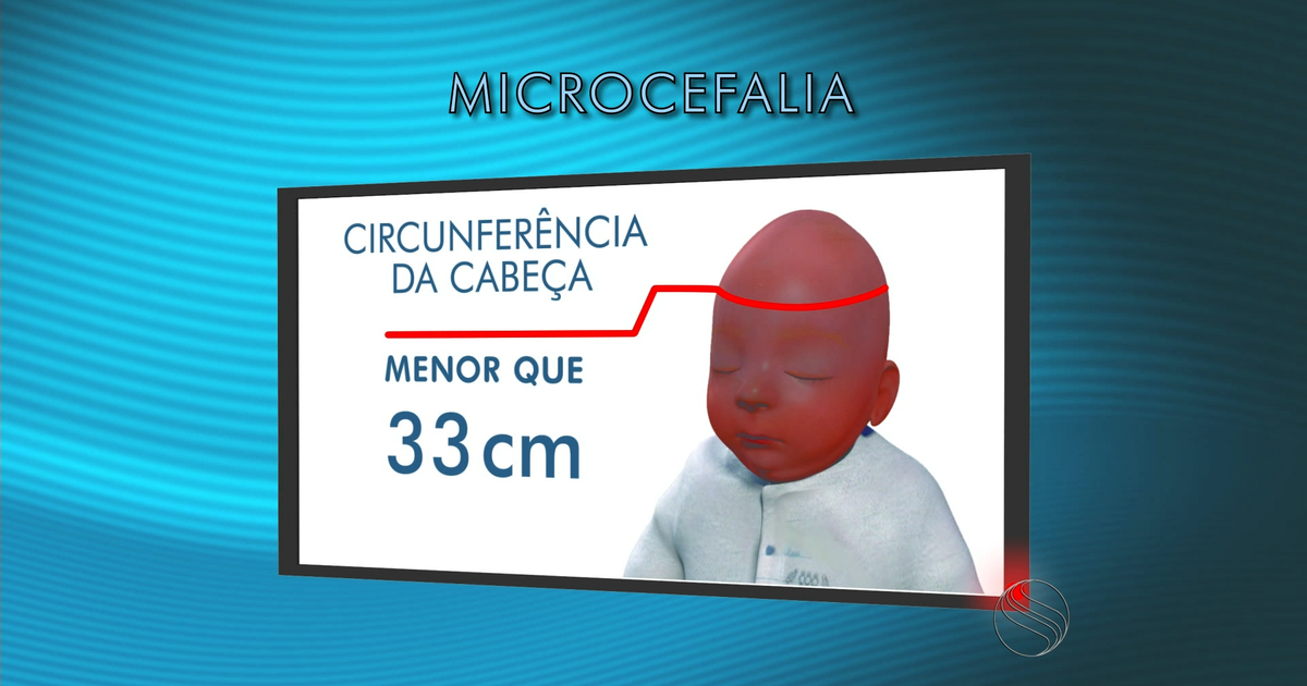 G1 - Sergipe apresenta dados alarmantes de bebês com microcefalia ...