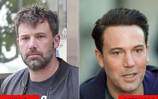 Ben Affleck surge com aparência muito jovial e especialista sugere ...