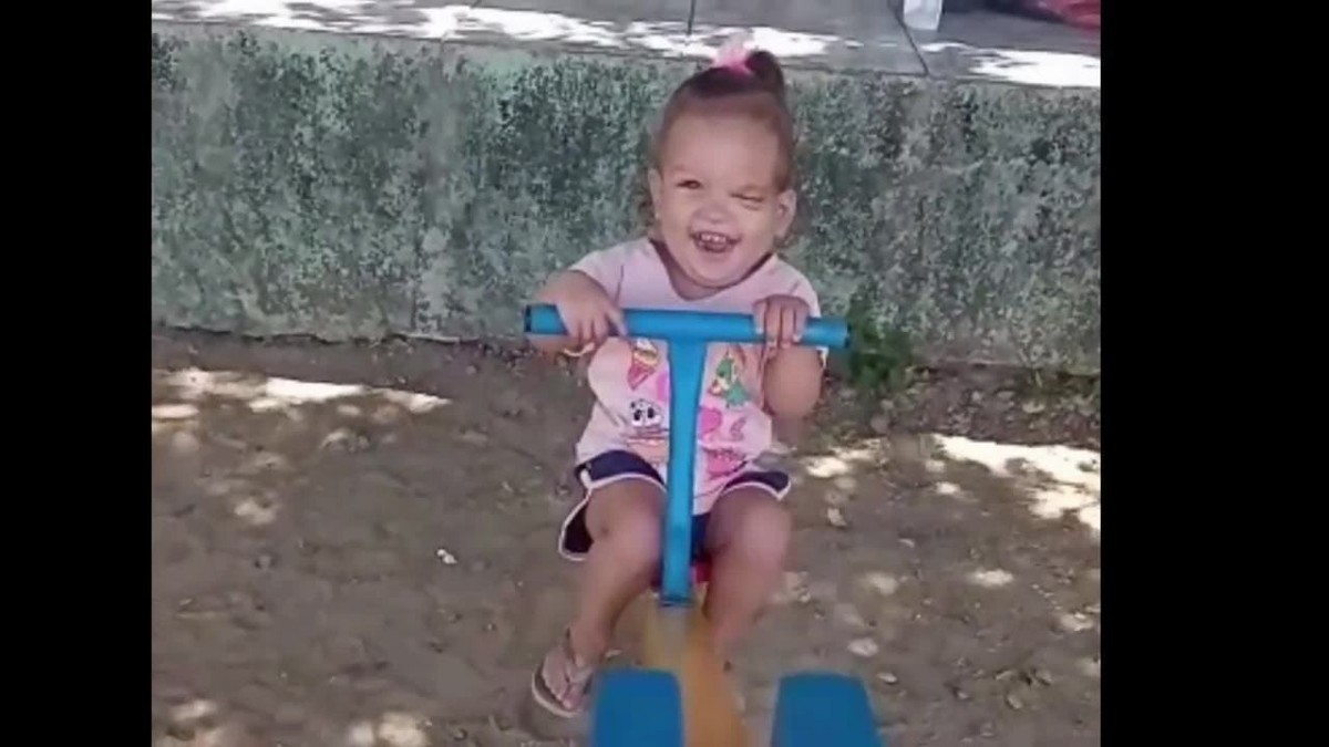 Criança com tumor raro no rosto passa por cirurgia e tem melhora após ...