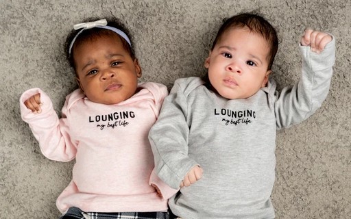 “Uma chance em um milhão”: mãe dá à luz gêmeos com tons de pele ...