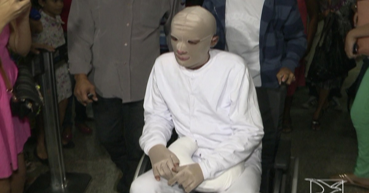 G1 - Homem queimado durante ataques em São Luís volta para casa ...