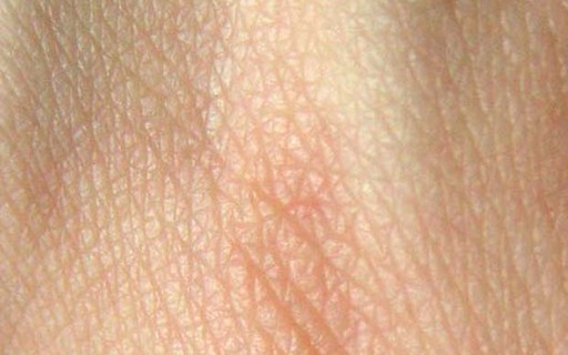 Inteligência artificial vence dermatologistas no diagnóstico de câncer ...