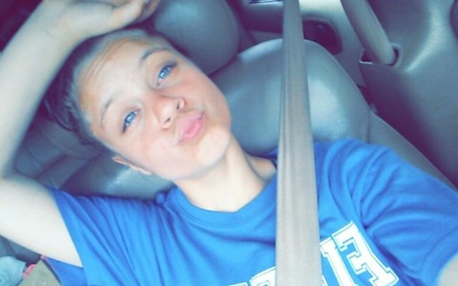 Mulher que sobreviveu a ataque de três pit bulls é intubada após ...