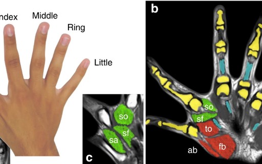 Ter 6 dedos seria uma vantagem evolutiva, afirma novo estudo - Revista ...
