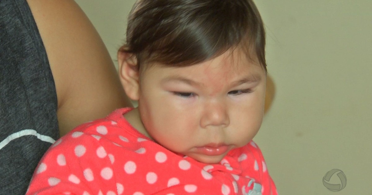G1 - Mãe de bebê com microcefalia em MT cria página para ajudar outras ...