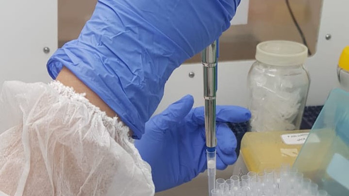 NUBEX atinge marca de 3.515 exames de Covid-19 diagnosticados ...