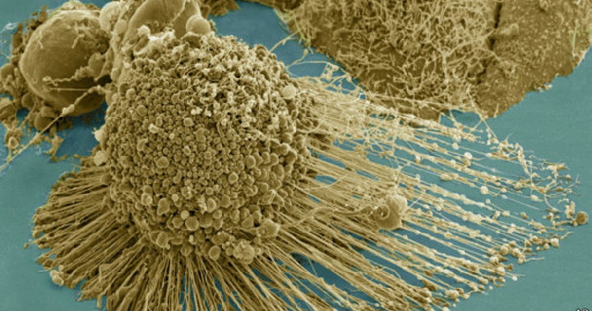 G1 - Estudo identifica mutações que dão origem a câncer - notícias em ...