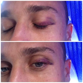 Um olho roxo e só: sem lesão após pancada, Milton é liberado para treinar