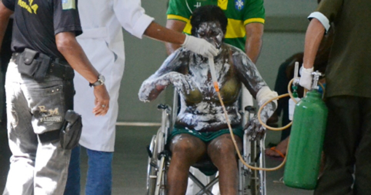 G1 - Morre detenta grávida queimada após 10 dias na UTI em Parnaíba (PI ...