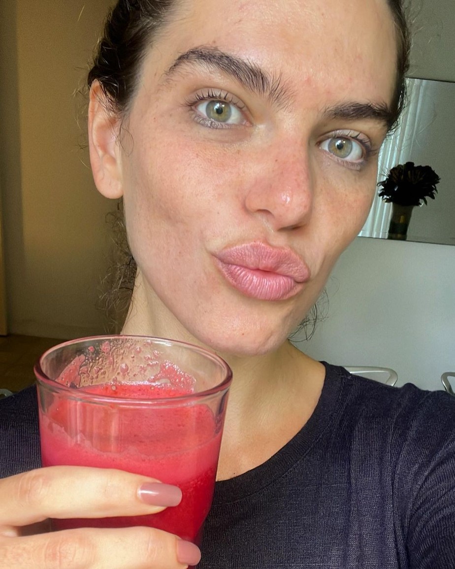 Mariana Goldfarb lembra anorexia: "estava doente, achava que eu tinha ...